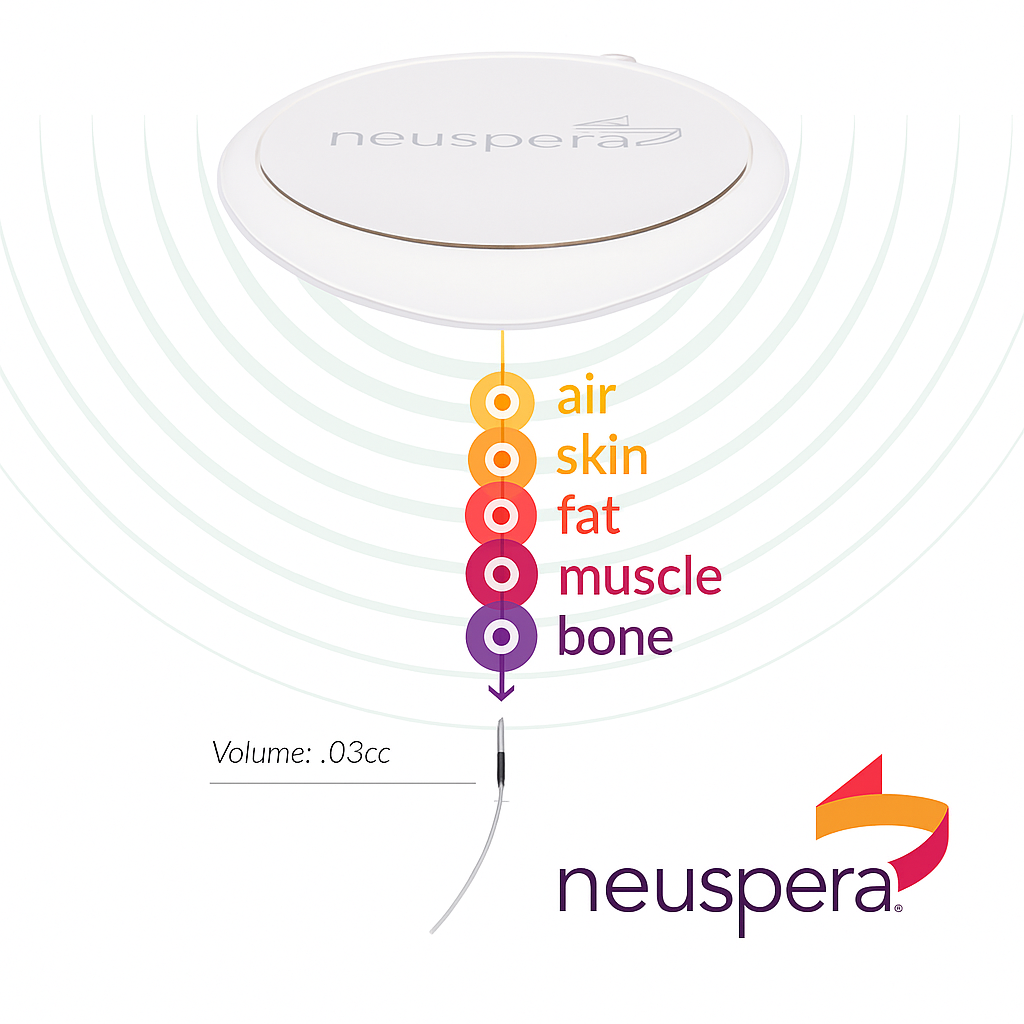 Neuspera Medical Receives FDA Approval for First Integrated Sacral ...